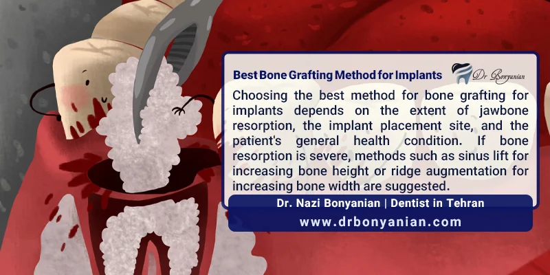 Dental Bone Grafting: Procedure, Recovery, Costs & Why You Need It