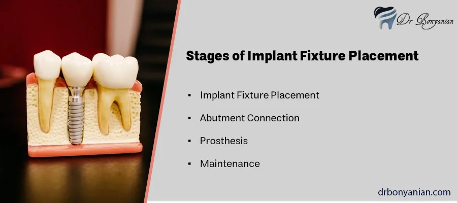 Dental Implant Fixture: Your Complete Guide (Types, Material & Care)