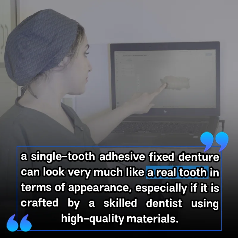 Single-Tooth Adhesive Denture: Pros, Cons & Cost